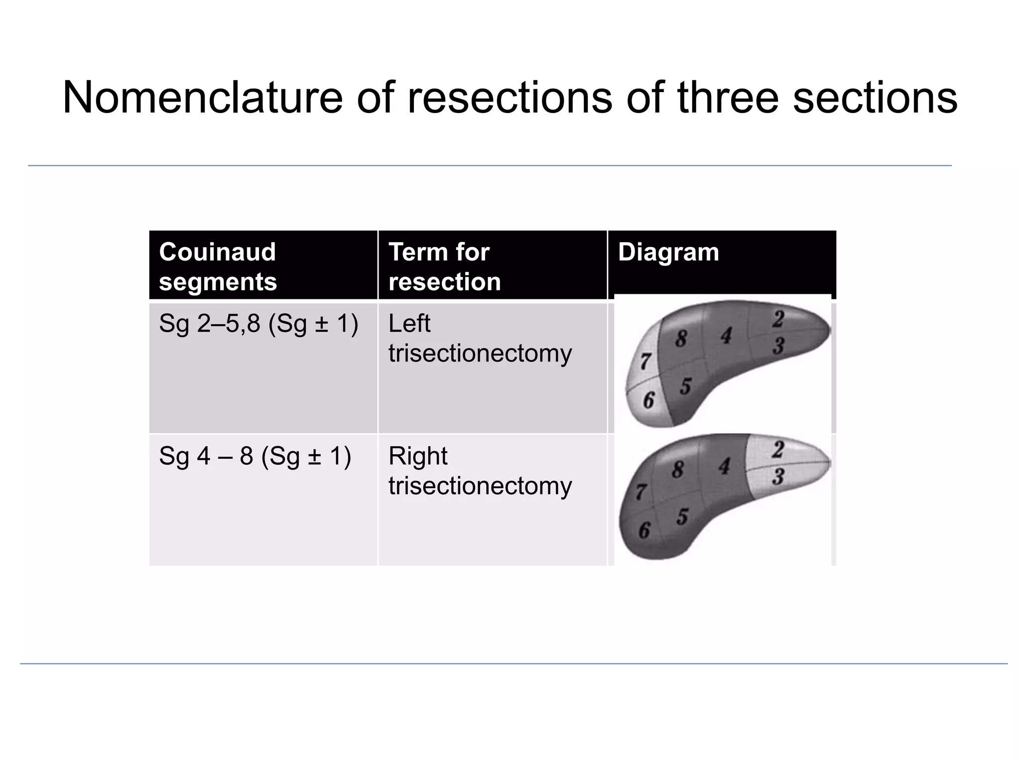 Liver anatomy and terminology, in brief, 2018, by R. Lunevicius | PPT