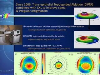 Dr. Lovisolo "The Triple Procedure: ICR + tomo-linked PTK + CXL" | PPT