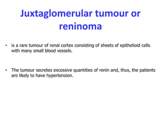 TUMOURS OF KIDNEY | PPTX