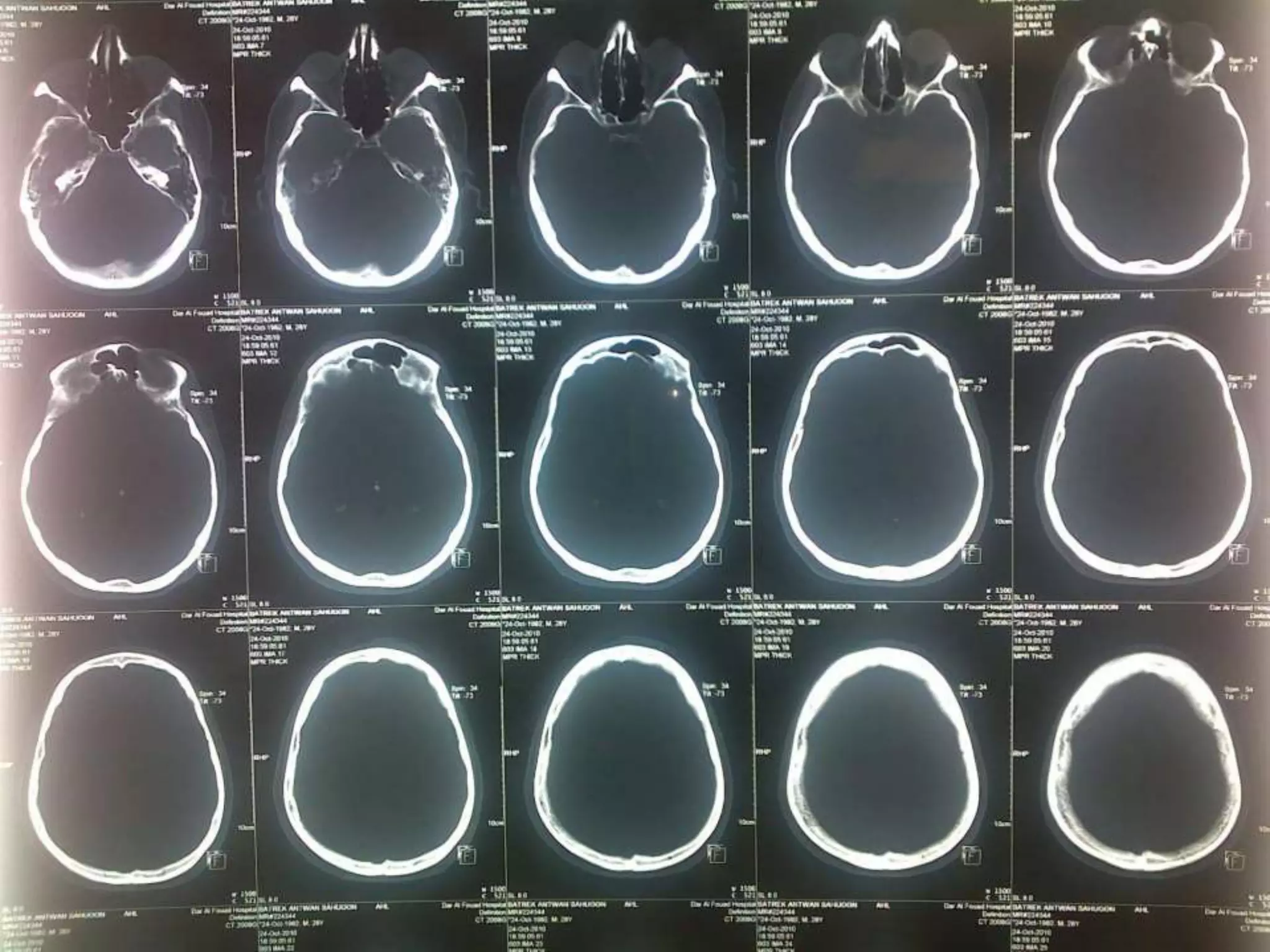 1- Management of poly-trauma patient.pptx