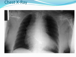 1- Management of poly-trauma patient.pptx