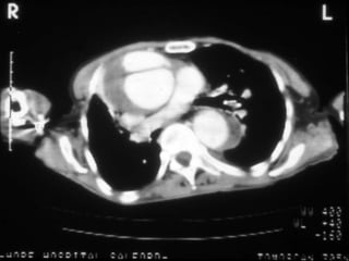 1- Management of poly-trauma patient.pptx