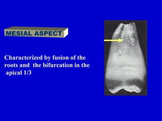 05. Maxillary Molars (Lecture) - Dentition | PPT