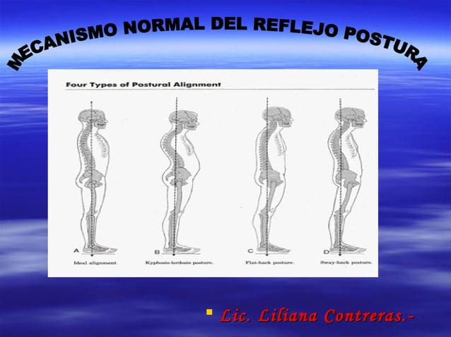 1 mecanismo normal del reflejo postural | PPT