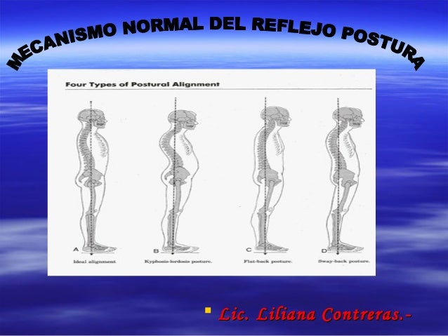 1 mecanismo normal del reflejo postural