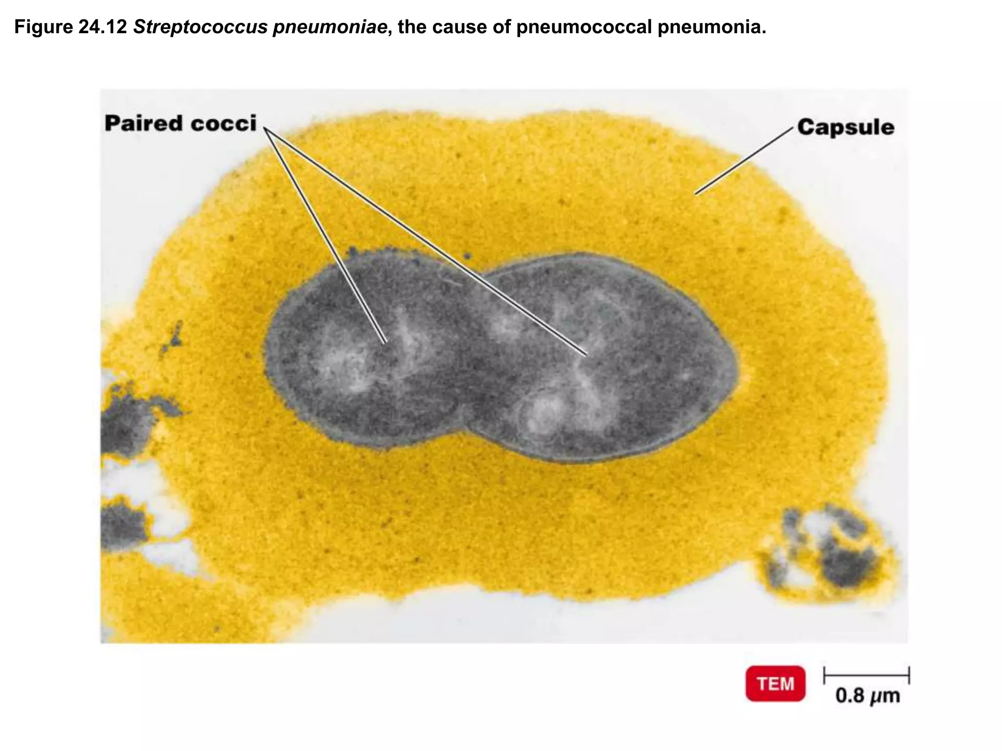 1 - Microbial World and Prokaryotic Cell Anatomy | PPTX