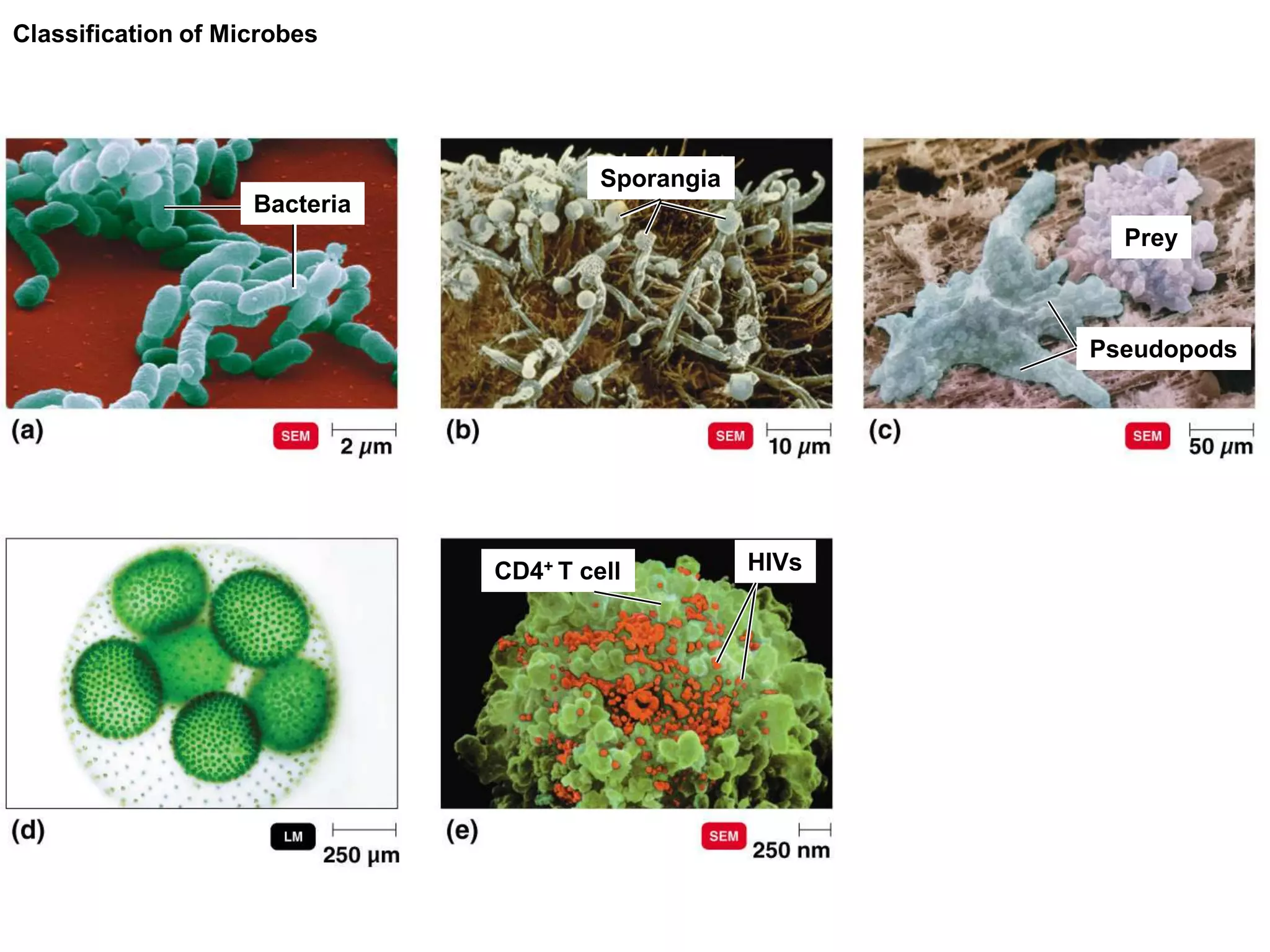 1 - Microbial World and Prokaryotic Cell Anatomy | PPT