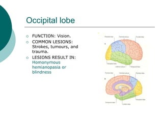 1 - Neurologic localization.ppt