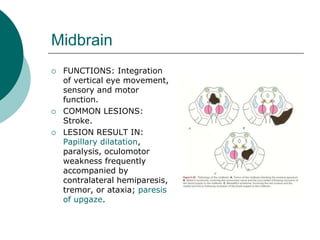 1 - Neurologic localization.ppt