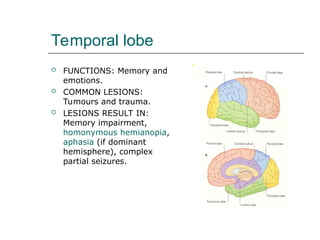 1 - Neurologic localization in the CNS(1).ppt