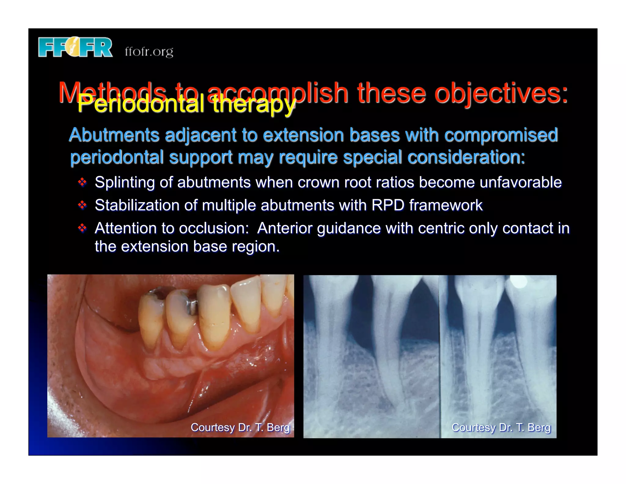 1.(new)introduction and basic components of rpd's | PDF