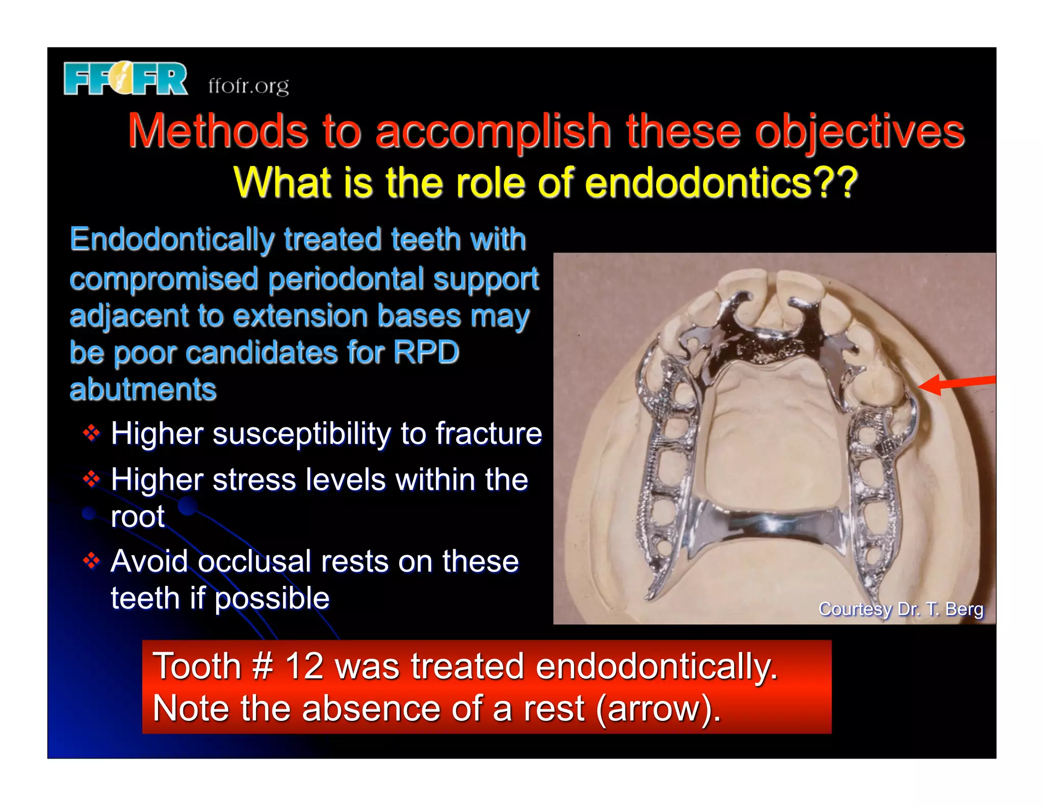 1.(new)introduction and basic components of rpd's | PDF
