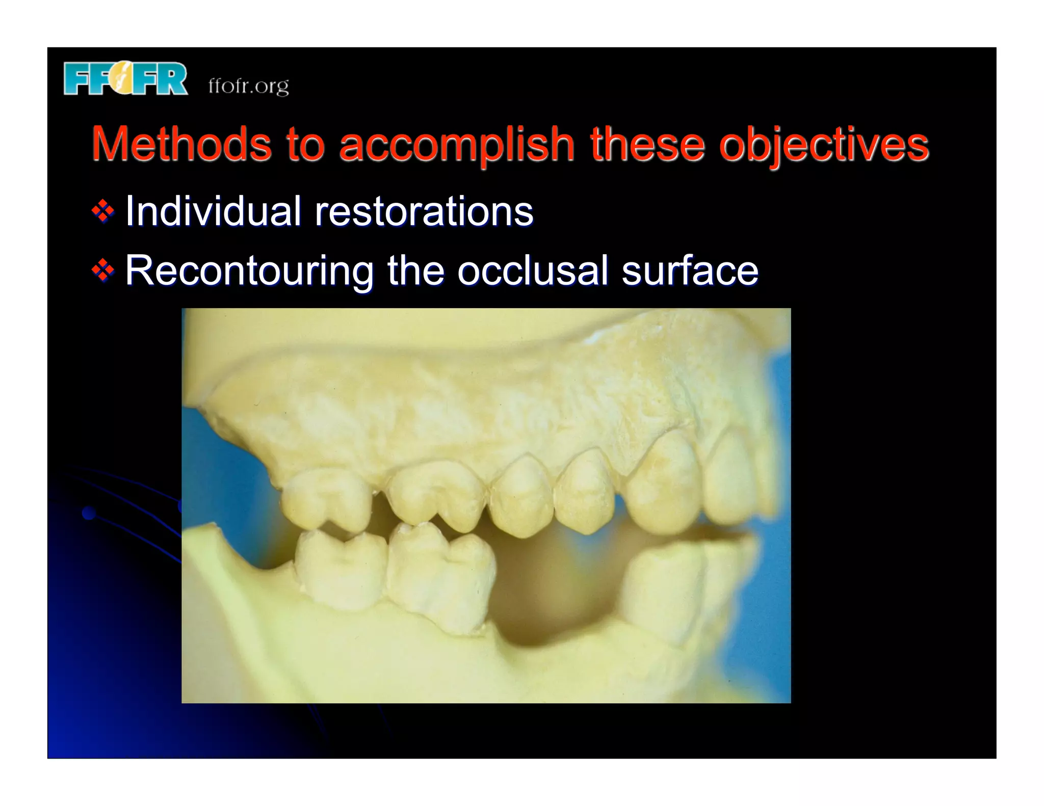 1.(new)introduction and basic components of rpd's | PDF