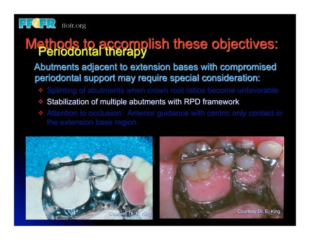 1.(new)introduction and basic components of rpd's | PDF | Dental Health ...