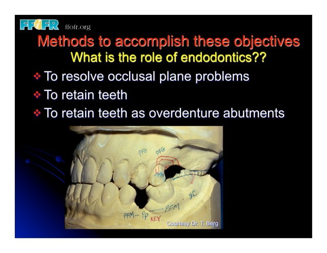 1.(new)introduction and basic components of rpd's | PDF | Dental Health ...