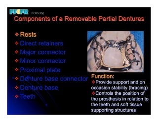 1.(new)introduction and basic components of rpd's | PDF