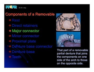 1.(new)introduction and basic components of rpd's | PDF