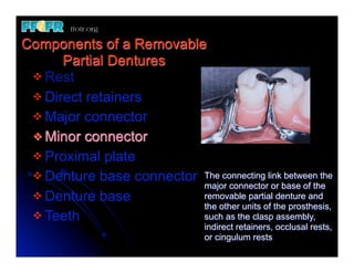 1.(new)introduction and basic components of rpd's | PDF