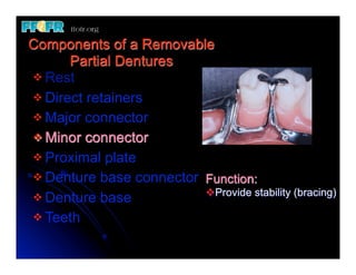 1.(new)introduction and basic components of rpd's | PDF