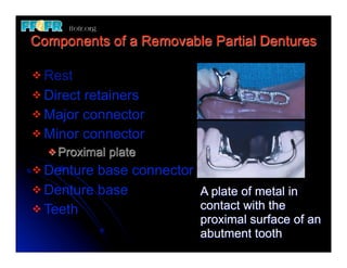 1.(new)introduction and basic components of rpd's | PDF