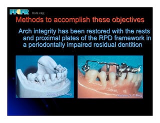 1.(new)introduction and basic components of rpd's | PDF