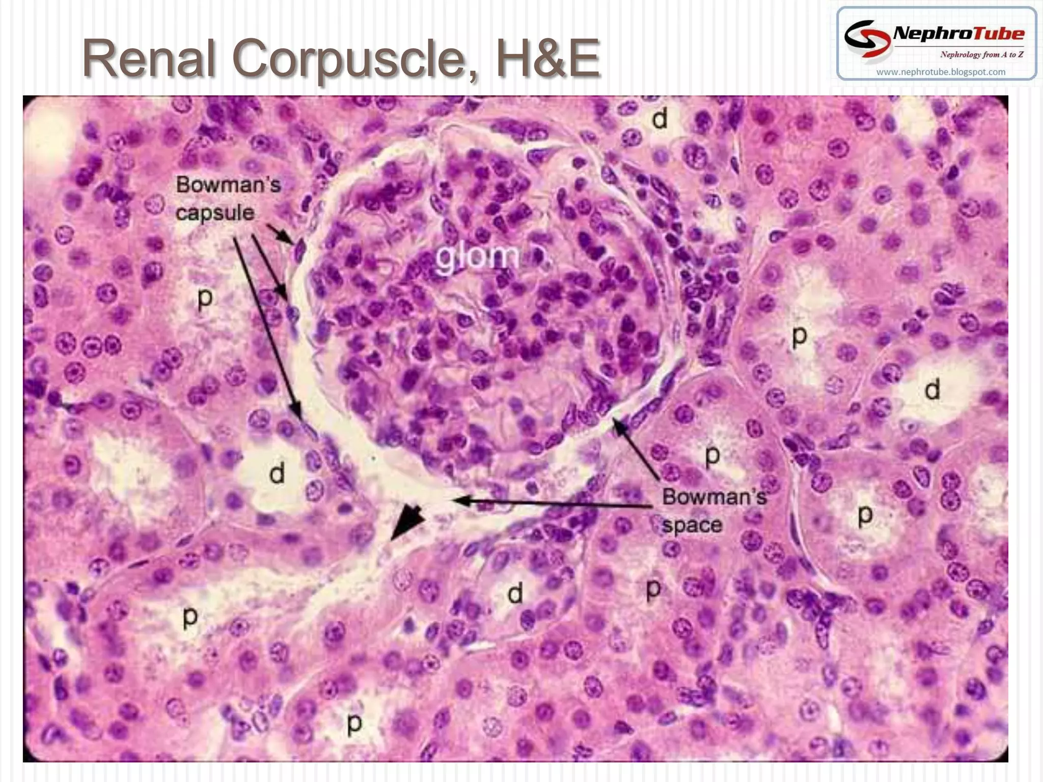 Renal Histo-Pathology (I) - Normal Kidney Light Microscopy - Dr. Gawad ...