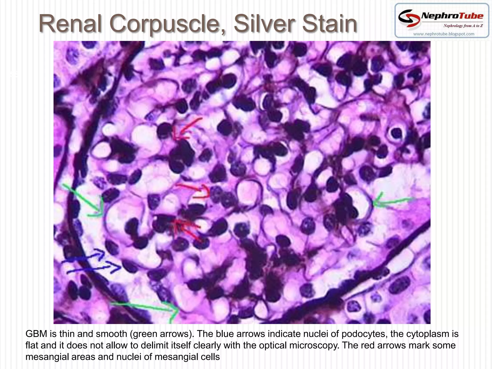 Renal Histo-Pathology (I) - Normal Kidney Light Microscopy - Dr. Gawad ...