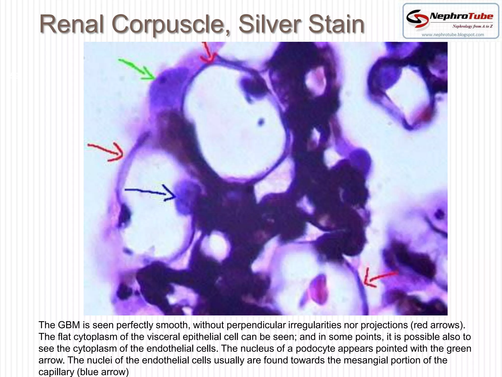 Renal Histo-Pathology (I) - Normal Kidney Light Microscopy - Dr. Gawad ...