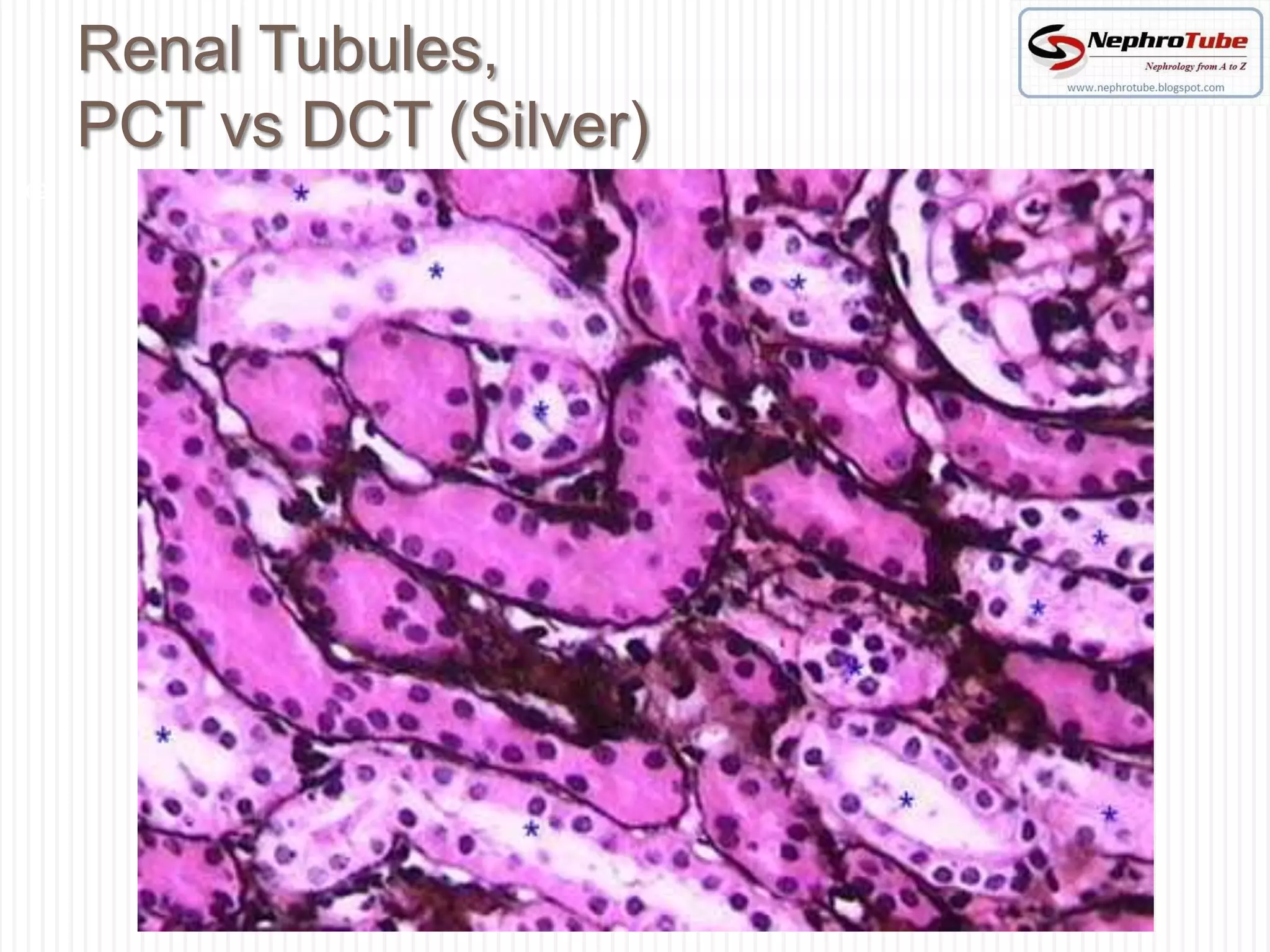Renal Histo-Pathology (I) - Normal Kidney Light Microscopy - Dr. Gawad ...