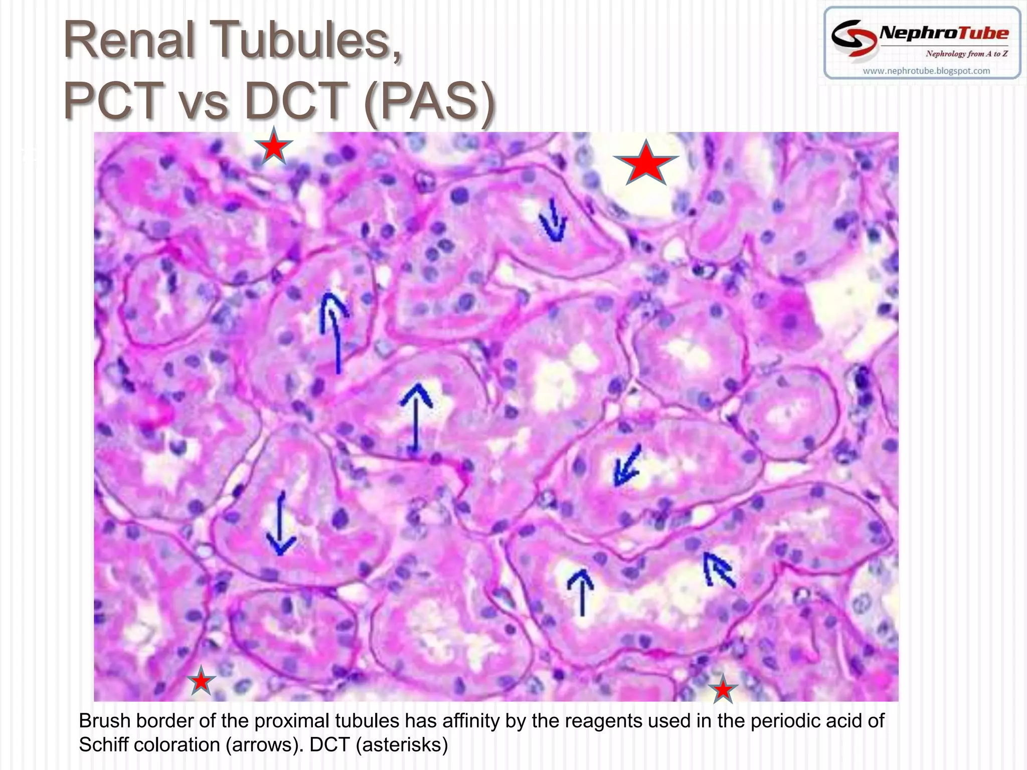 Renal Histo-Pathology (I) - Normal Kidney Light Microscopy - Dr. Gawad ...