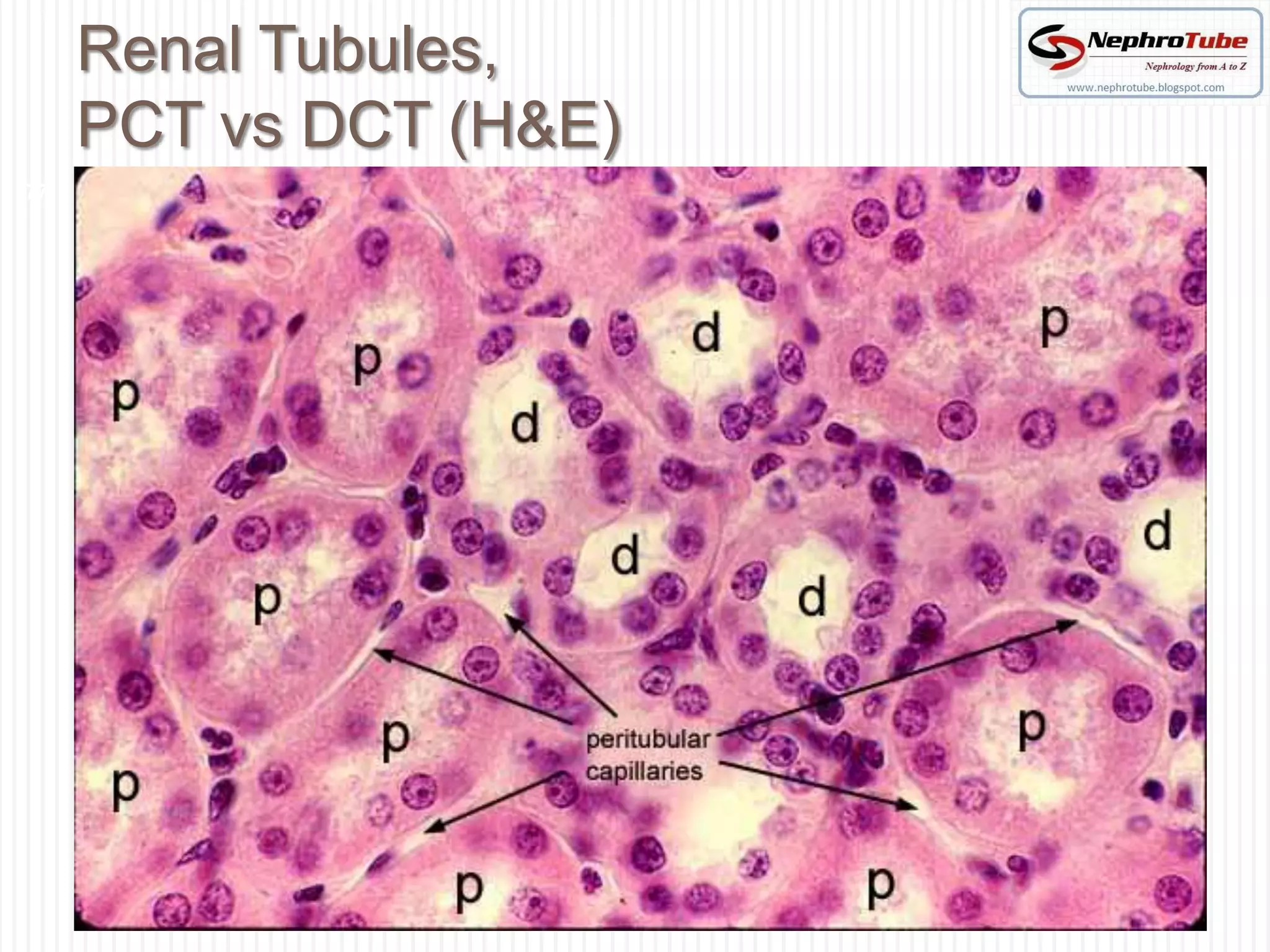 Renal Histo-Pathology (I) - Normal Kidney Light Microscopy - Dr. Gawad ...