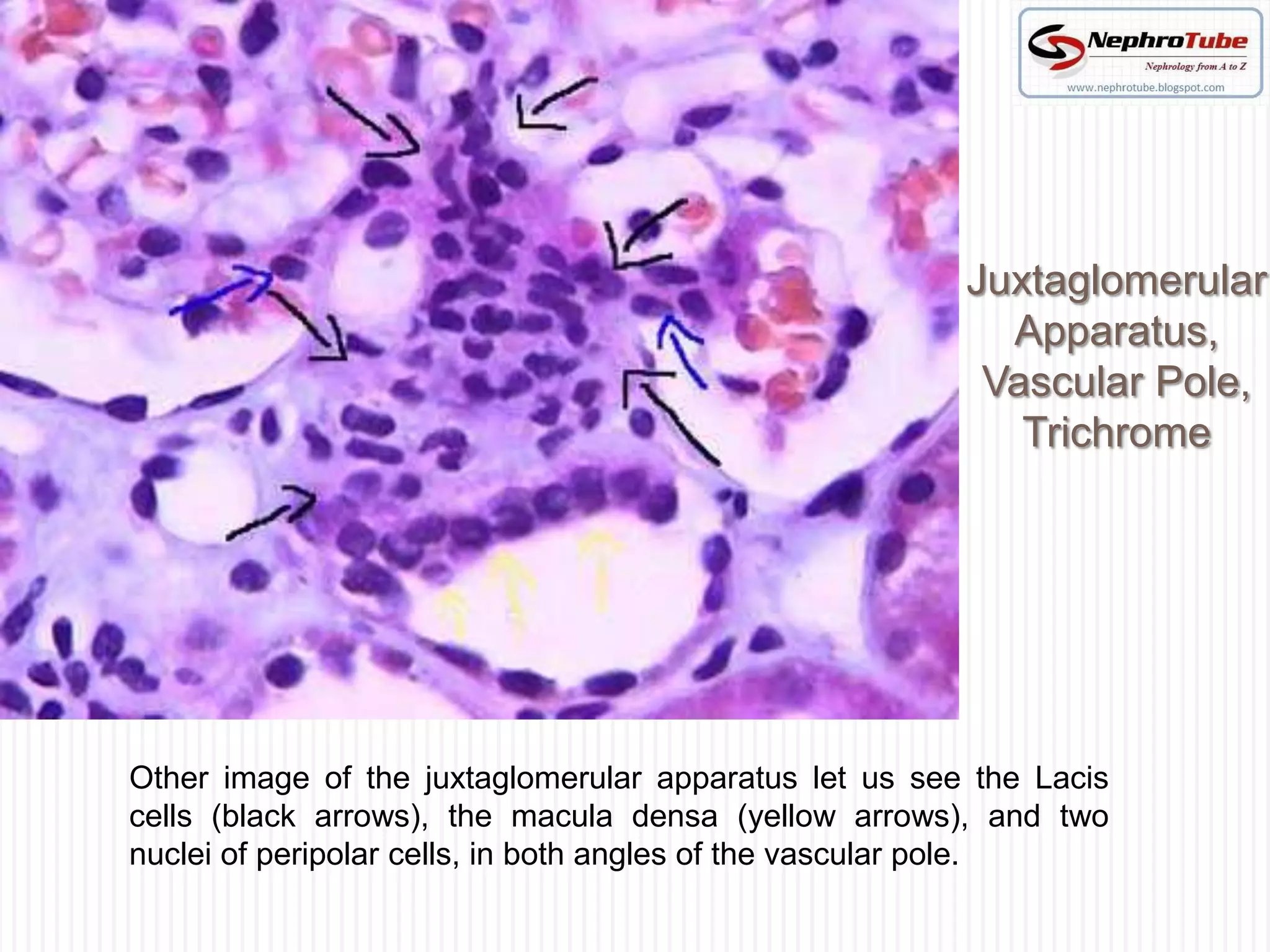Renal Histo-Pathology (I) - Normal Kidney Light Microscopy - Dr. Gawad ...