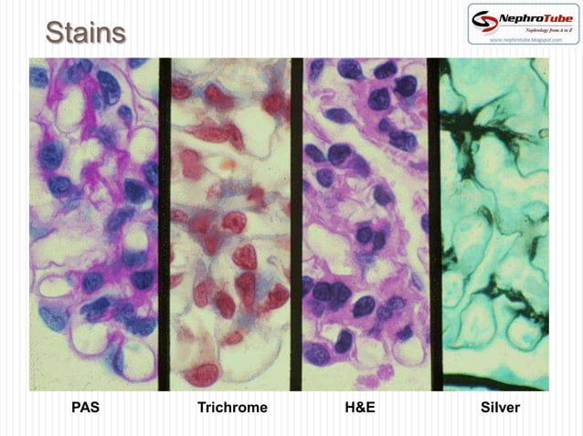 Renal Histo-Pathology (I) - Normal Kidney Light Microscopy - Dr. Gawad ...