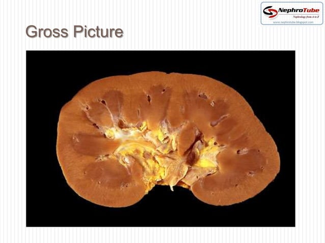 Renal Histo-Pathology (I) - Normal Kidney Light Microscopy - Dr. Gawad ...