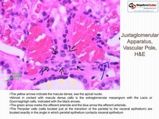 Renal Histo-Pathology (I) - Normal Kidney Light Microscopy - Dr. Gawad ...