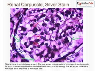 Mesangial Cell Histology