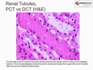 Renal Tubule Histology