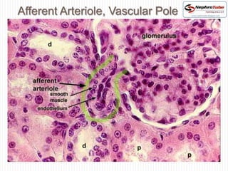 Labeled Kidney Slide