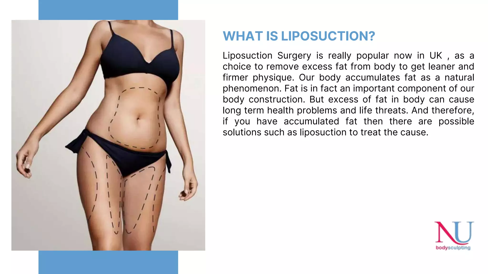 Liposuction - Comprehensive Guide | PPTX | Surgery | Medical Health