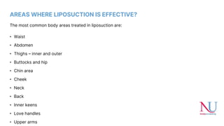 Liposuction - Comprehensive Guide | PPTX | Surgery | Medical Health