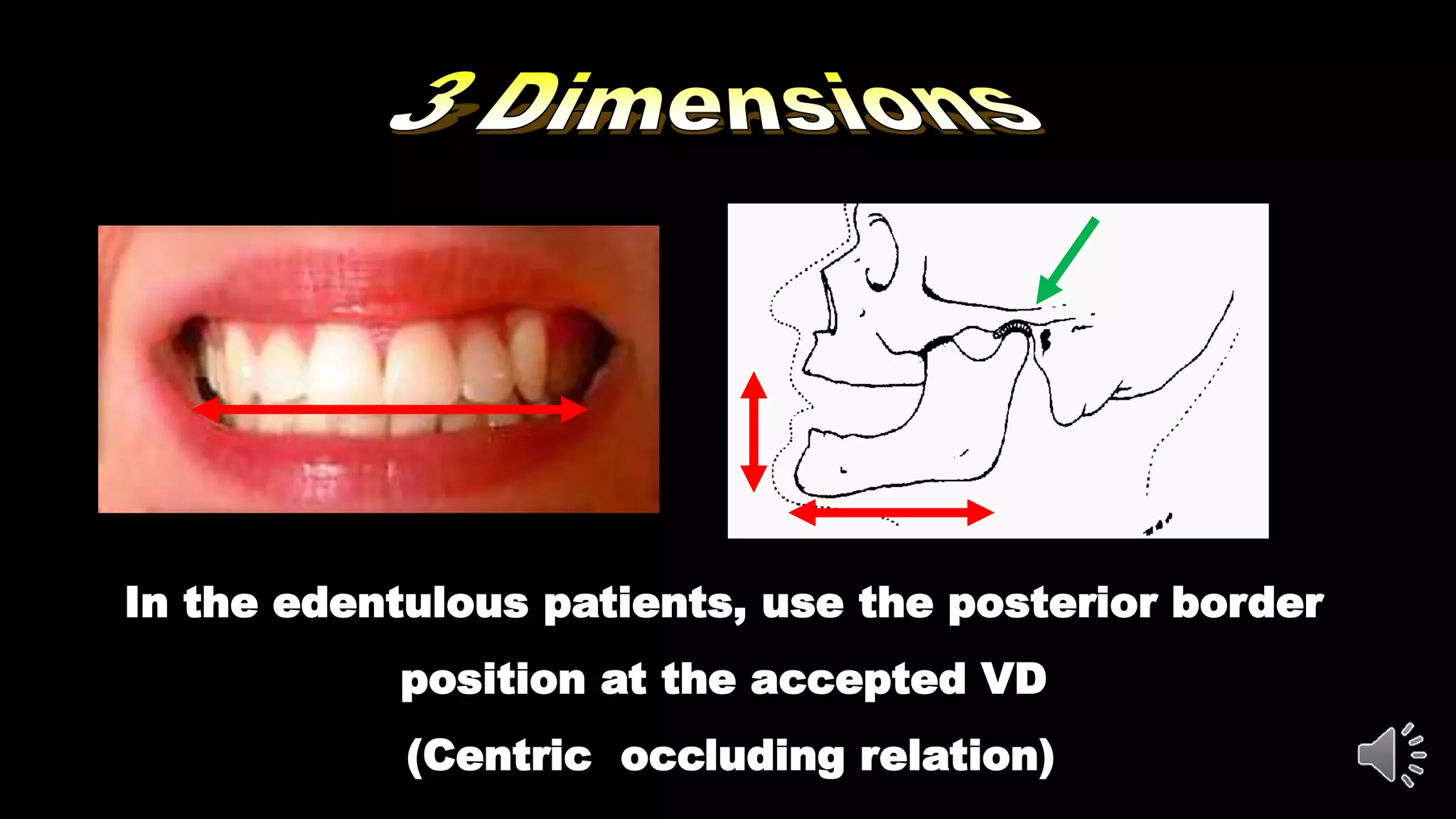 1 Occlusion in prosthodontics- introduction- differences between ...