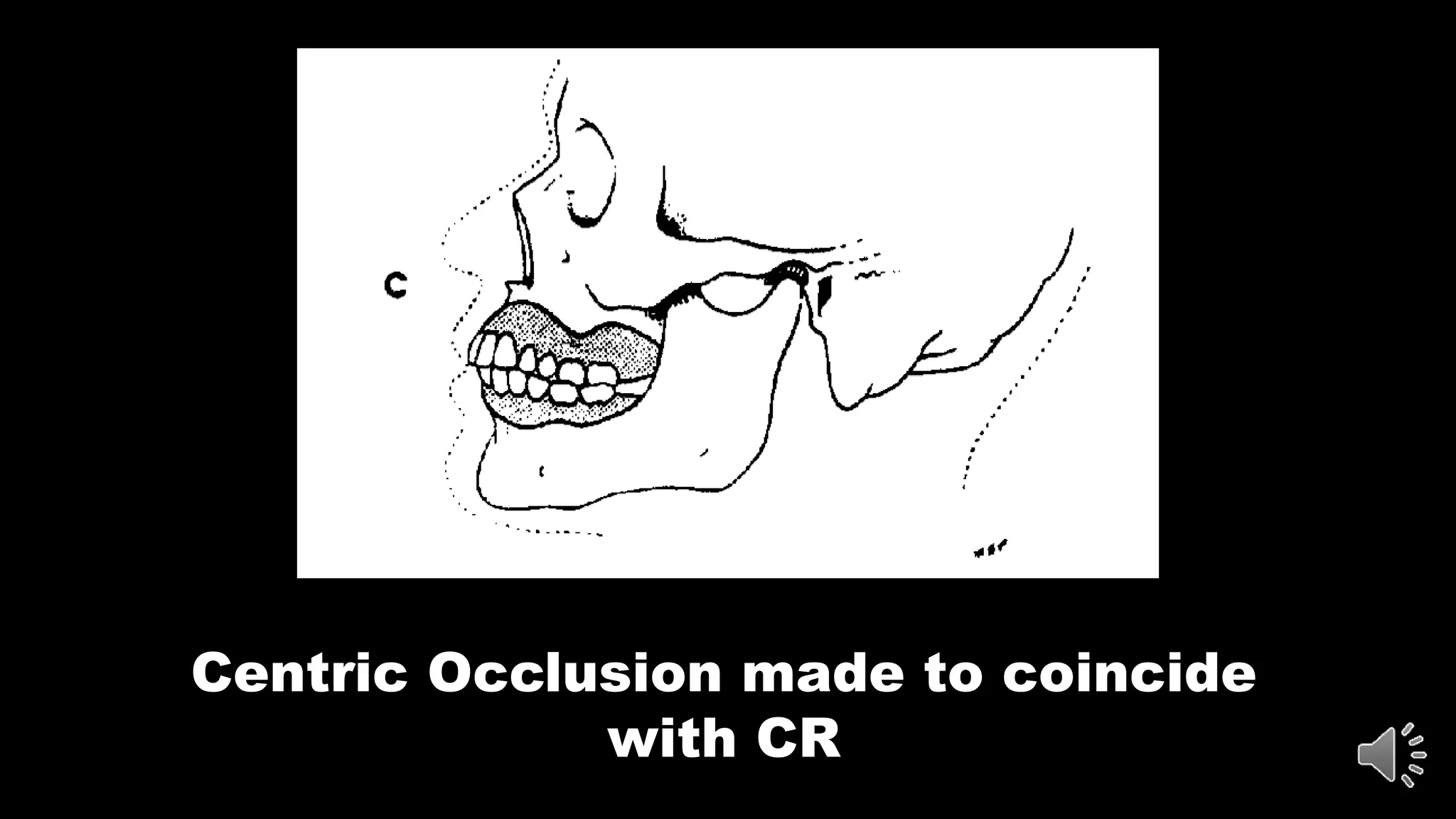 1 Occlusion in prosthodontics- introduction- differences between ...