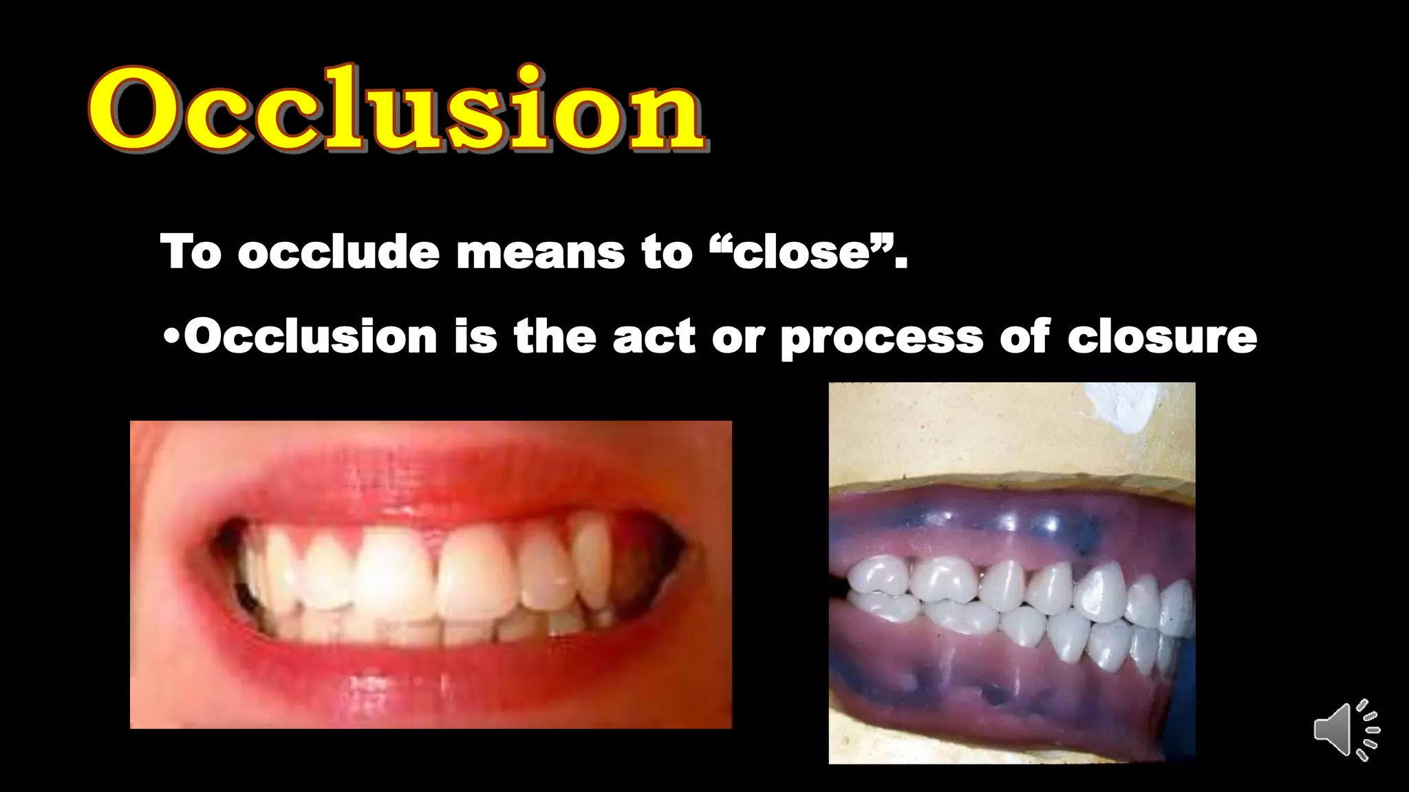 1 Occlusion in prosthodontics- introduction- differences between ...