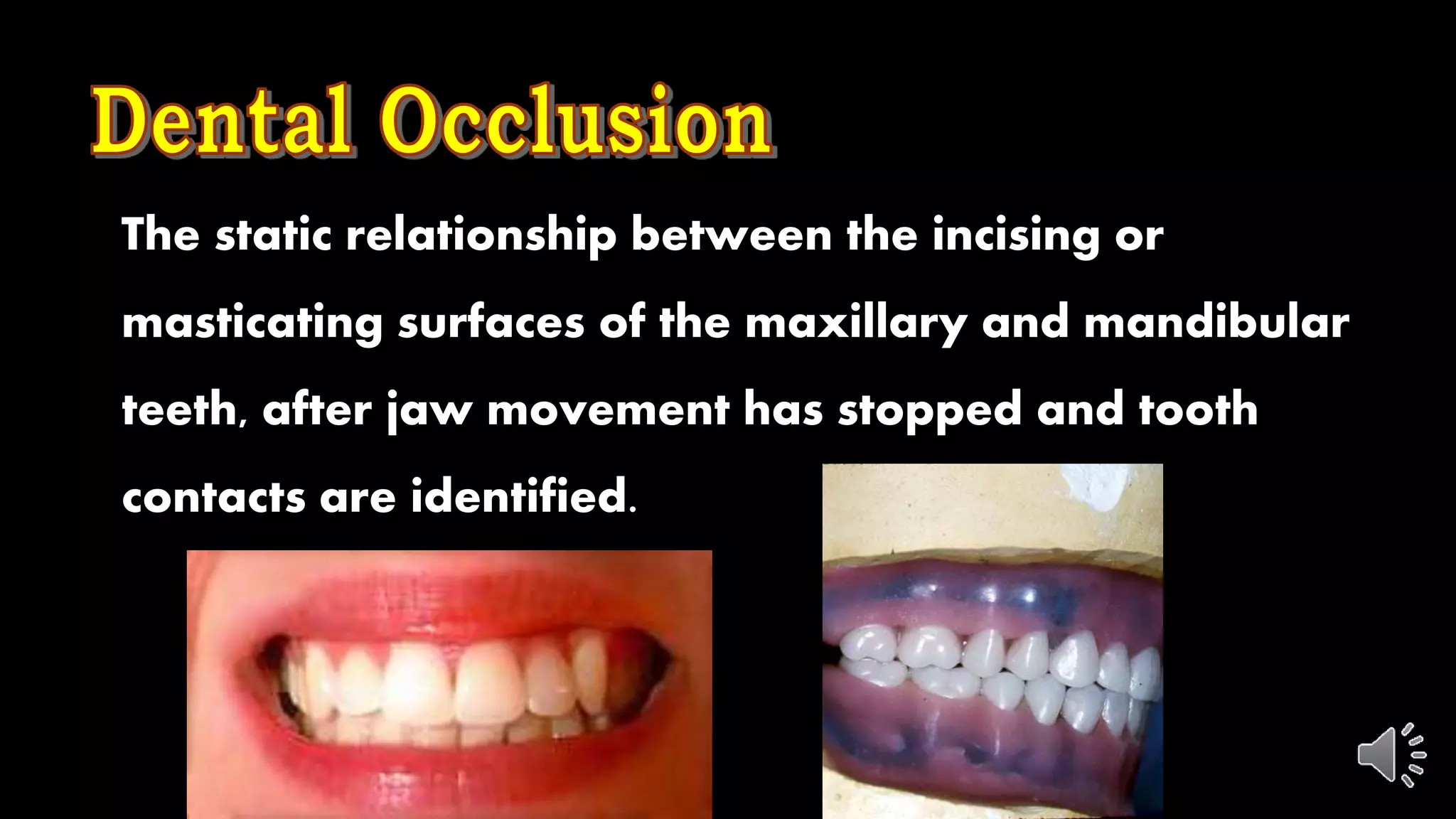 1 Occlusion in prosthodontics- introduction- differences between ...