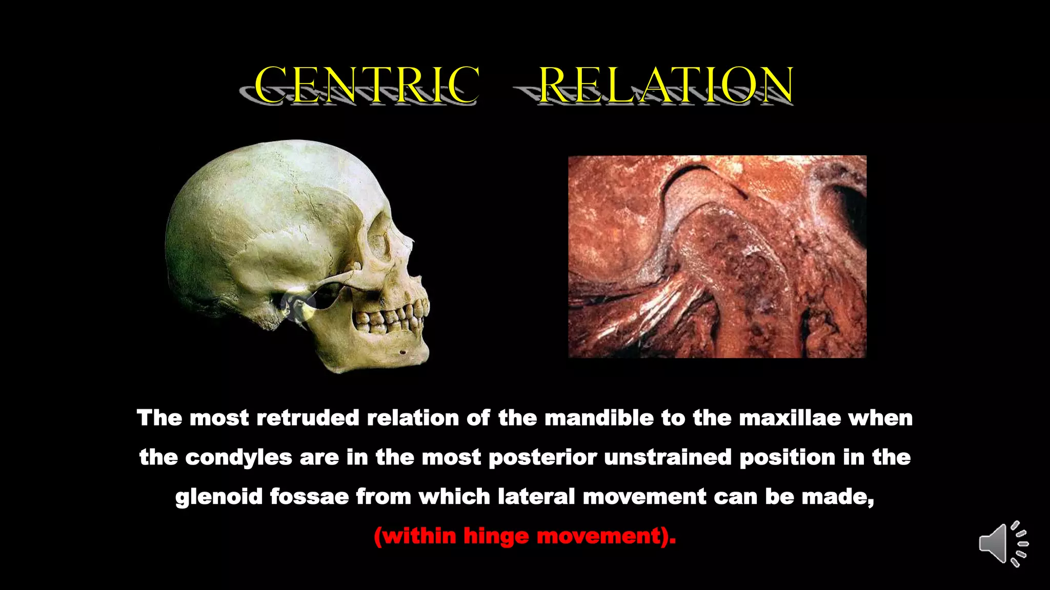 1 Occlusion in prosthodontics- introduction- differences between ...