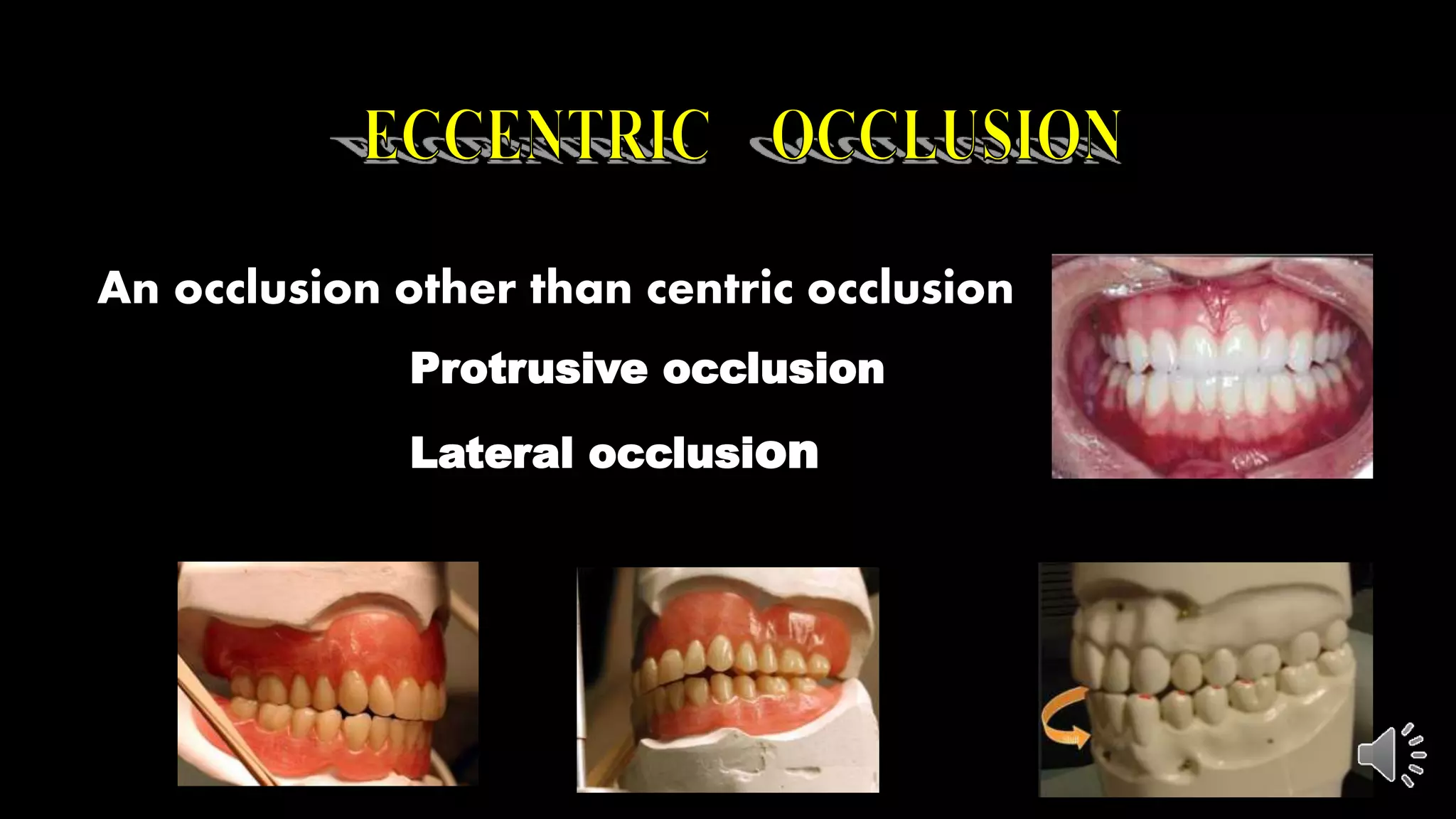 1 Occlusion in prosthodontics- introduction- differences between ...