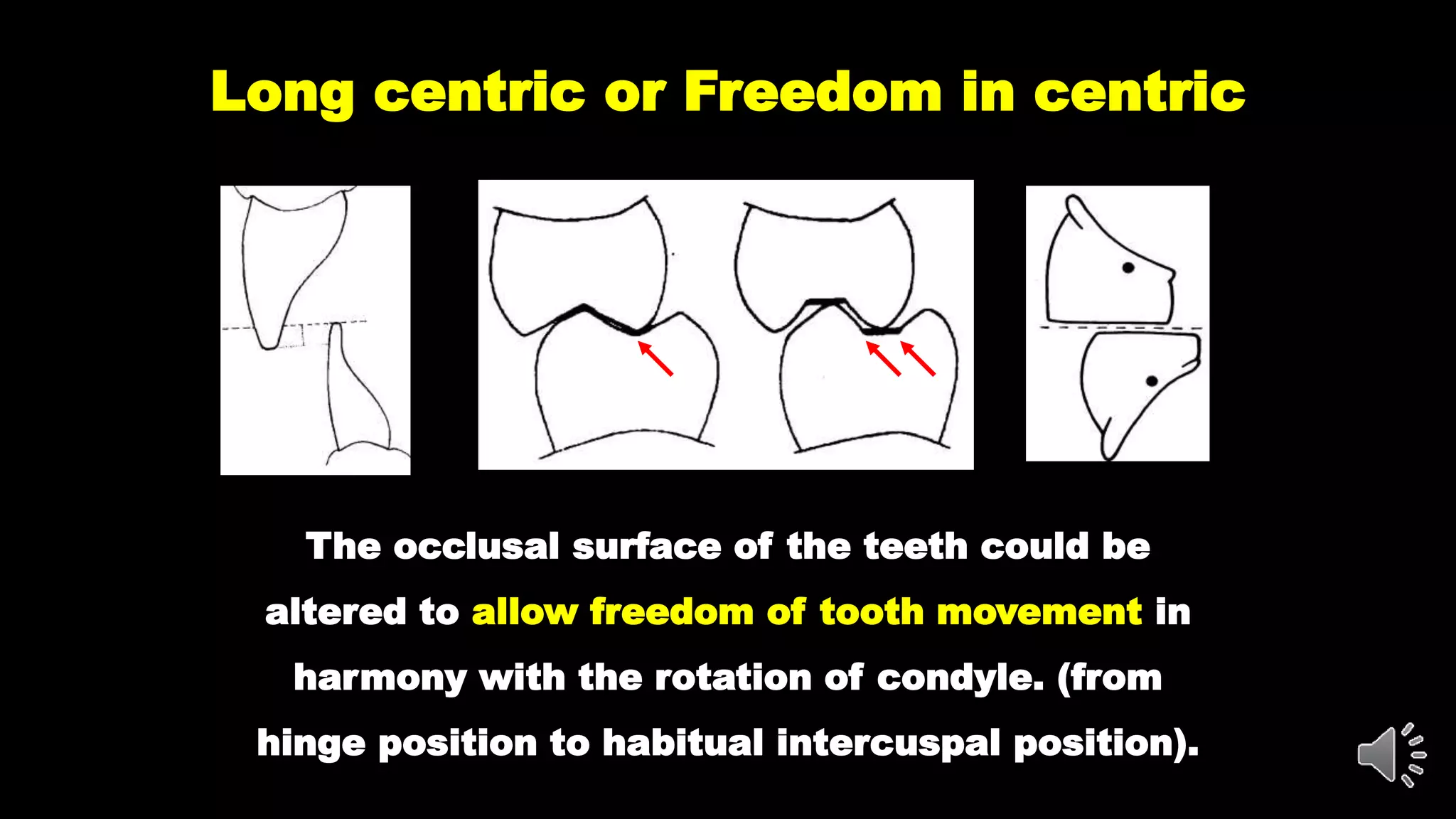 1 Occlusion in prosthodontics- introduction- differences between ...