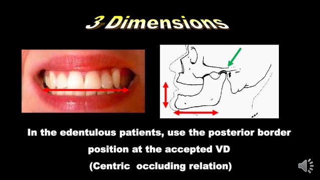 1 Occlusion in prosthodontics- introduction- differences between ...