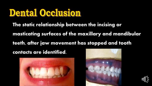 1 Occlusion in prosthodontics- introduction- differences between ...