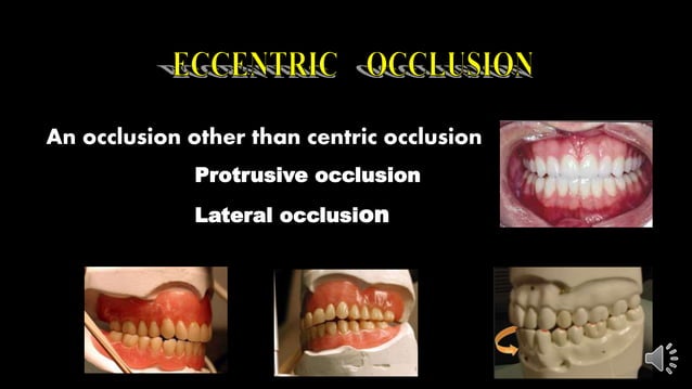 1 Occlusion in prosthodontics- introduction- differences between ...